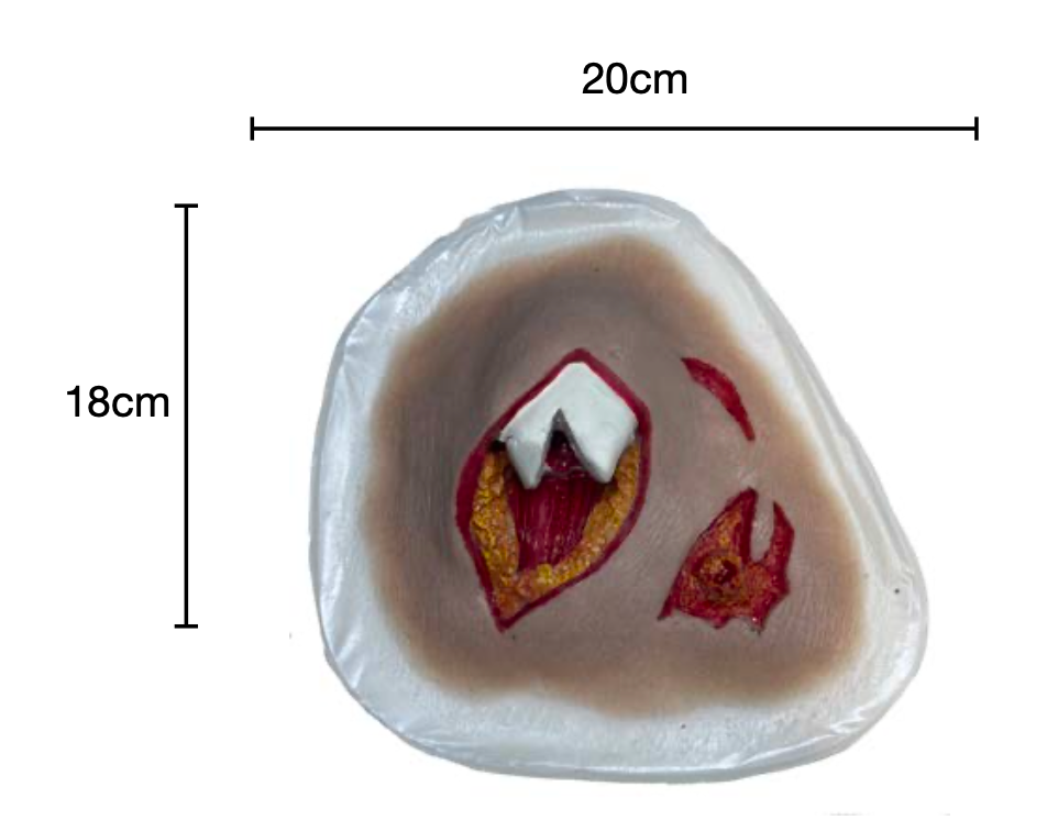 Saviour Medical - Flat Mould - Open Femur Fracture – The Makeup Armoury