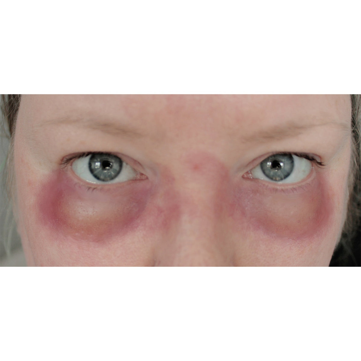 Jess FX - Silicone Bondo Mould - Swollen Eye Bags – The Makeup Armoury