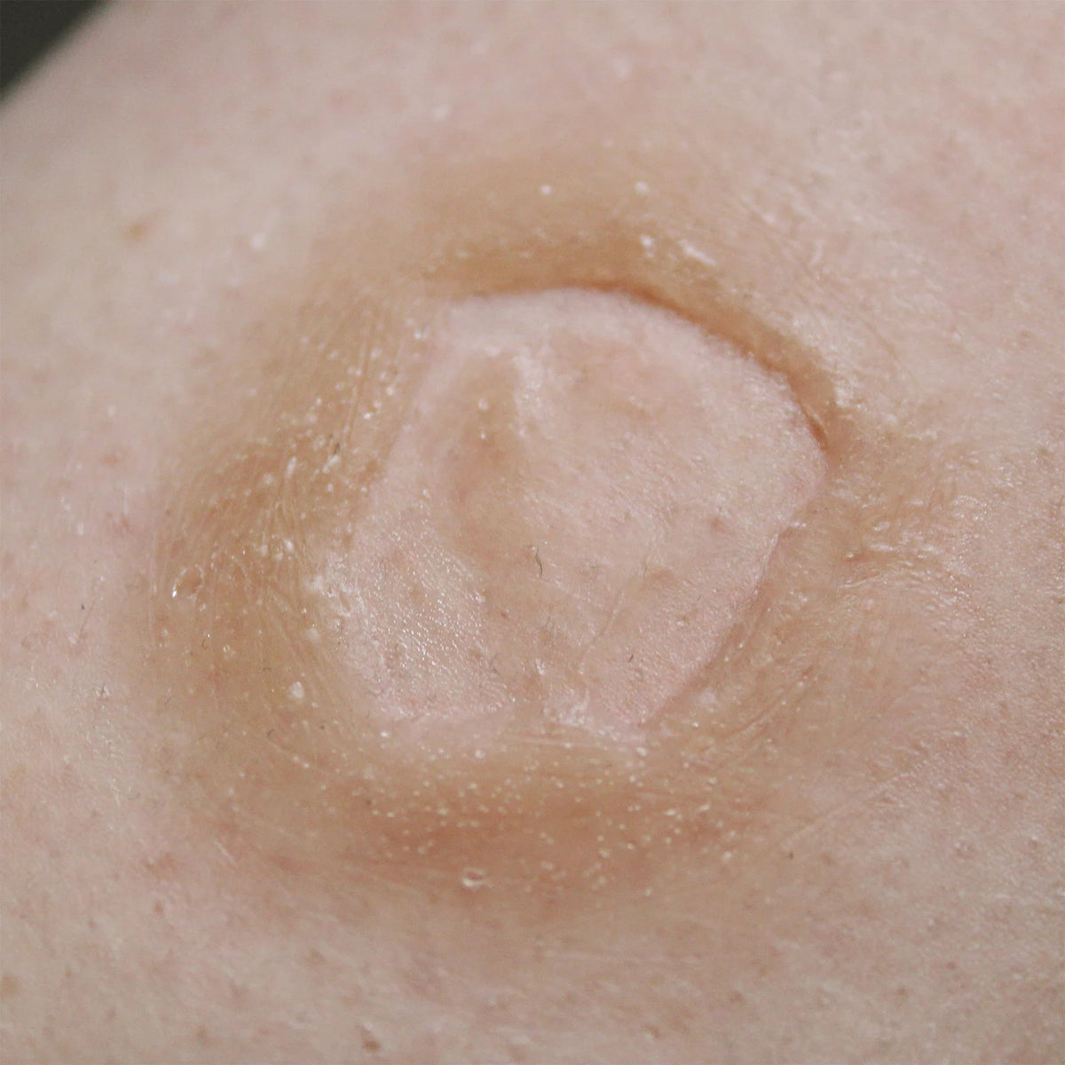 Jess FX - Silicone Bondo Mould - Gunshot Exit Wound (1 Mould) – The ...