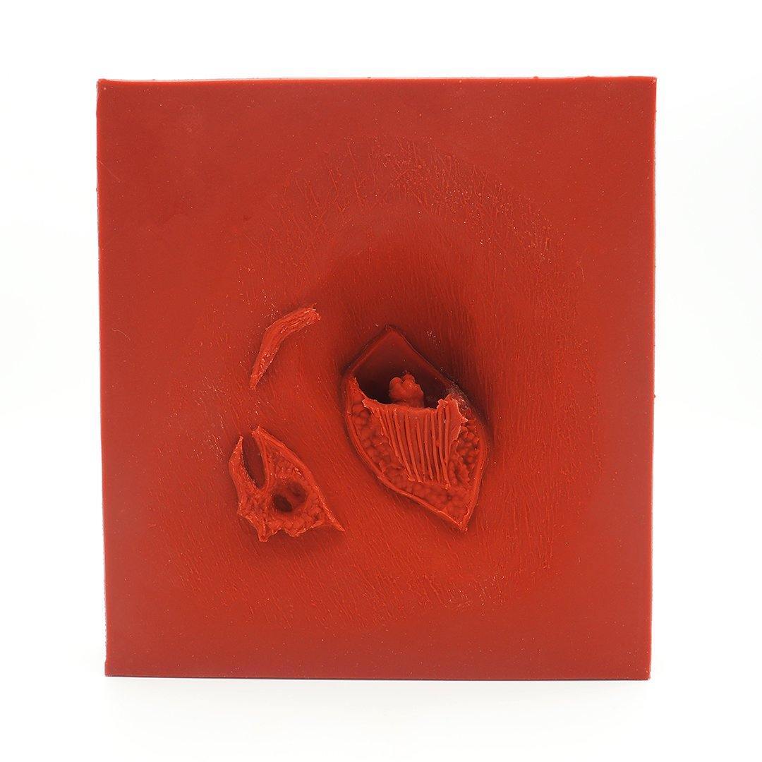 Saviour Medical - Flat Mould - Open Femur Fracture – The Makeup Armoury